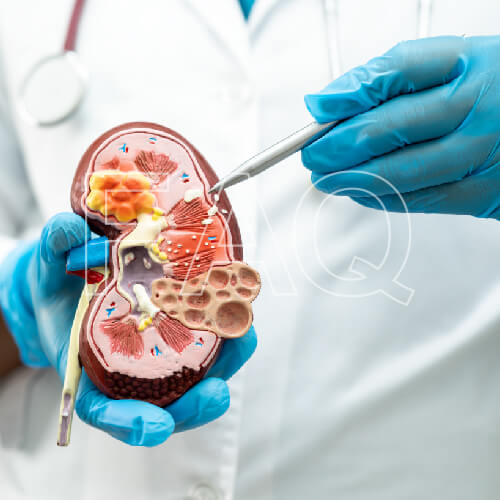 KidneyNeeds - Holistic app for all your Kidney's needs