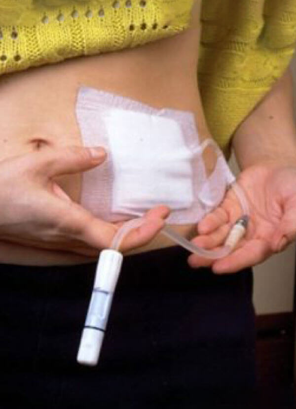 KidneyNeeds - Holistic app for all your Kidney's needs