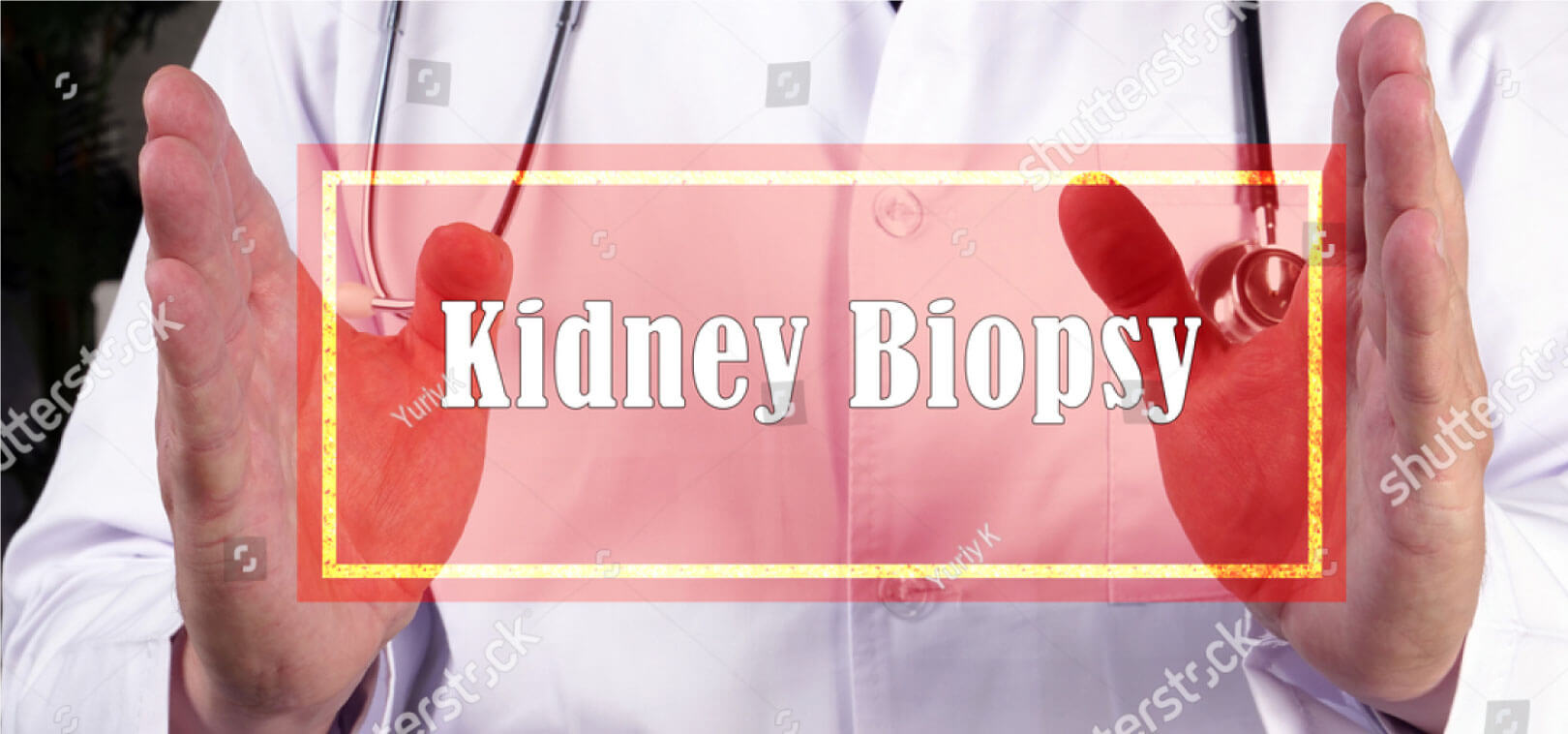 KidneyNeeds - Holistic app for all your Kidney's needs