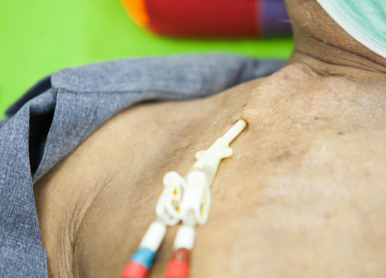 KidneyNeeds - Holistic app for all your Kidney's needs