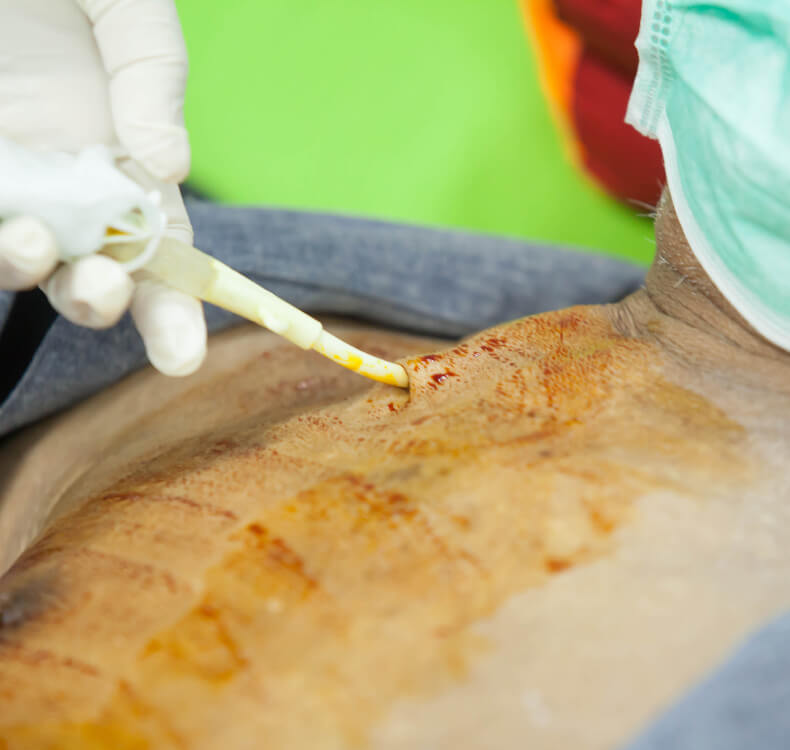 KidneyNeeds - Holistic app for all your Kidney's needs